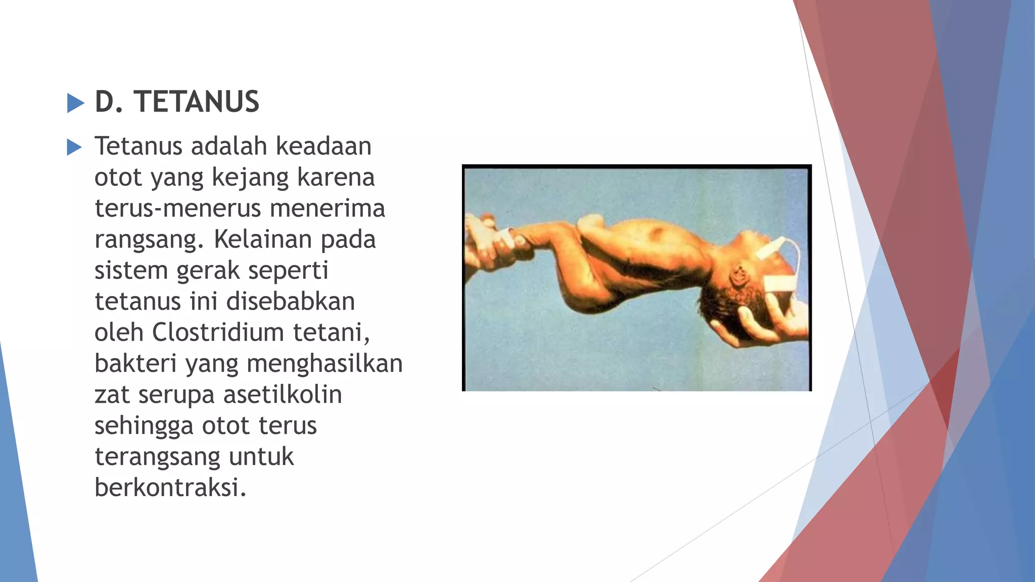 KELAINAN_PADA_OTOT_DAN_TULANG_ppt.pptx