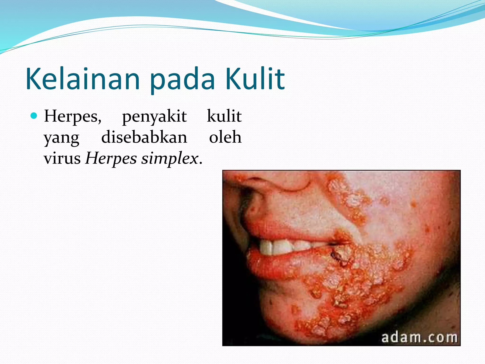 Kelainan pada respirasi & ekskresi kel iv | PPTX