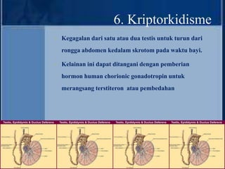 Kelainan pada sistem reproduksi ii copy | PPTX