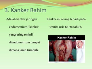 Kelainan pada sistem reproduksi ii copy | PPTX