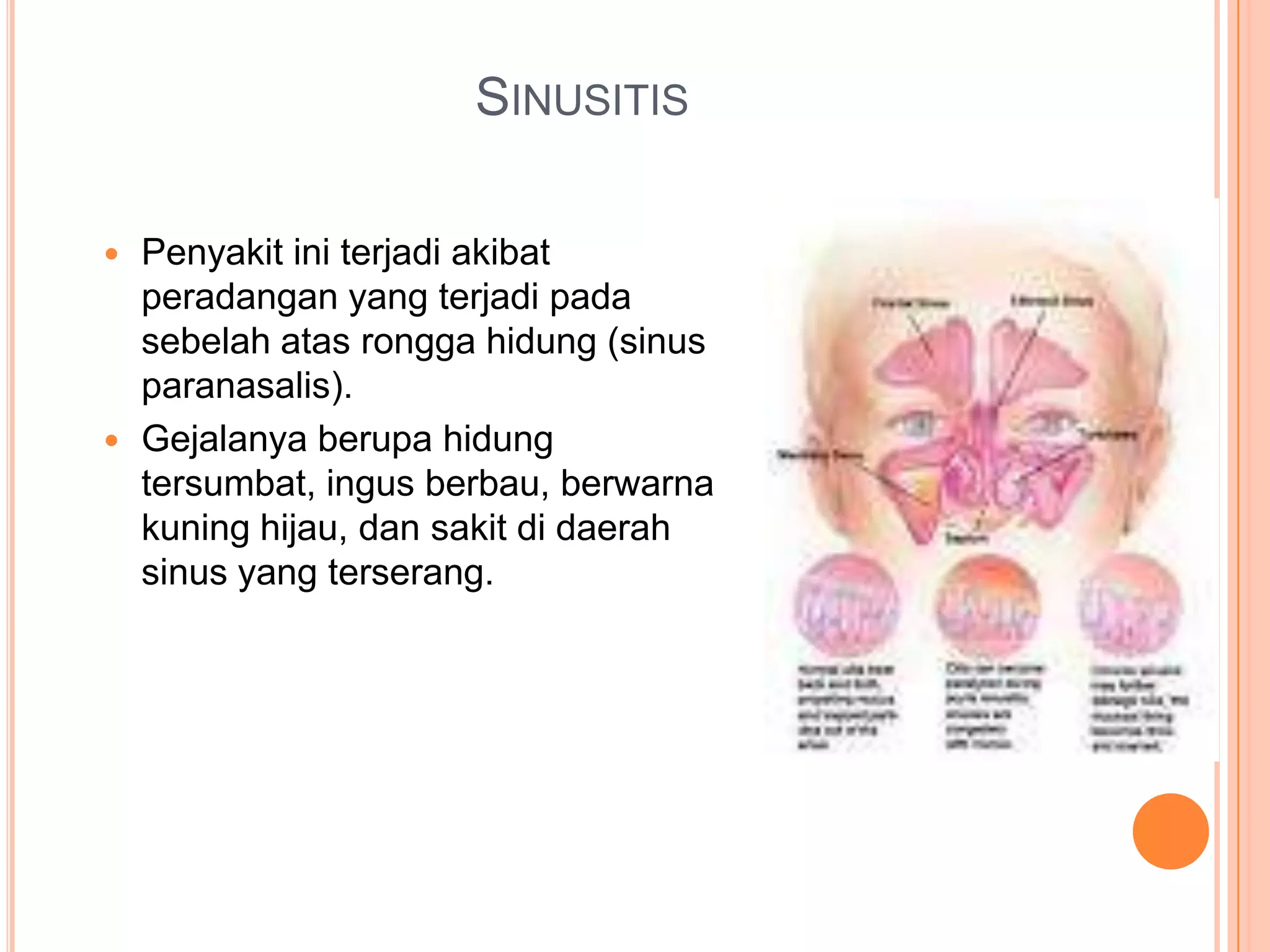 Kelainan & penyakit sistem pernapasan | PPTX