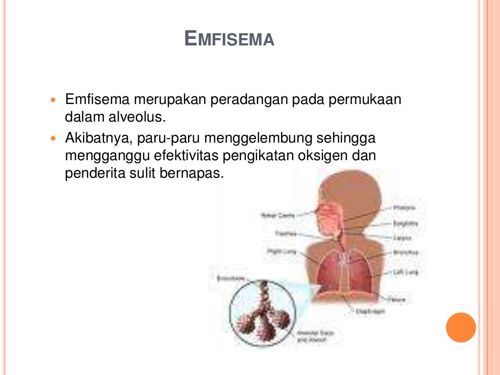 Kelainan & penyakit sistem pernapasan Kelainan & penyakit sistem pernapasan