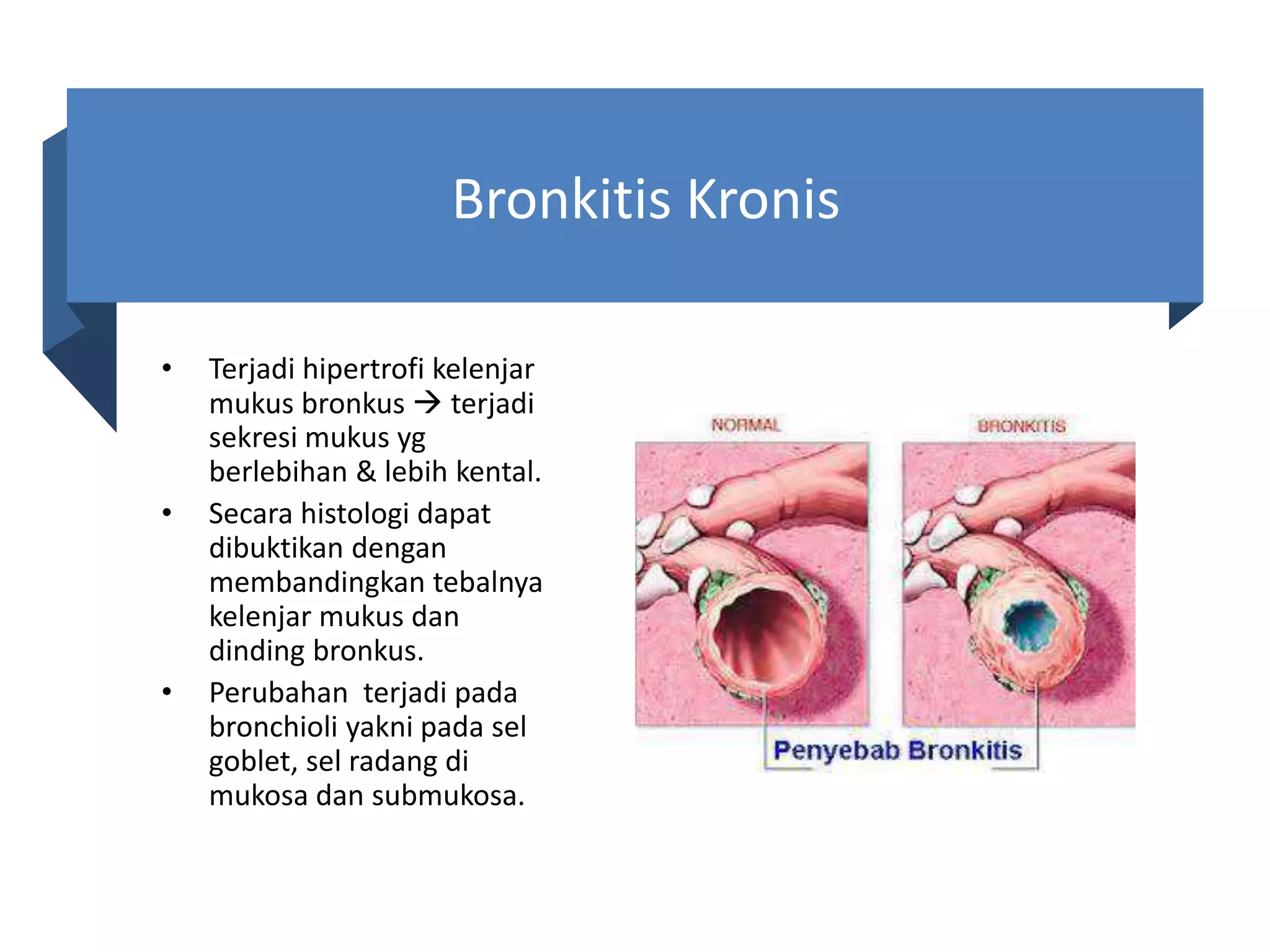 Kelainan Progresif.pptx
