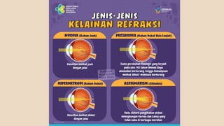 KELAINAN REFRAKSI.pptx