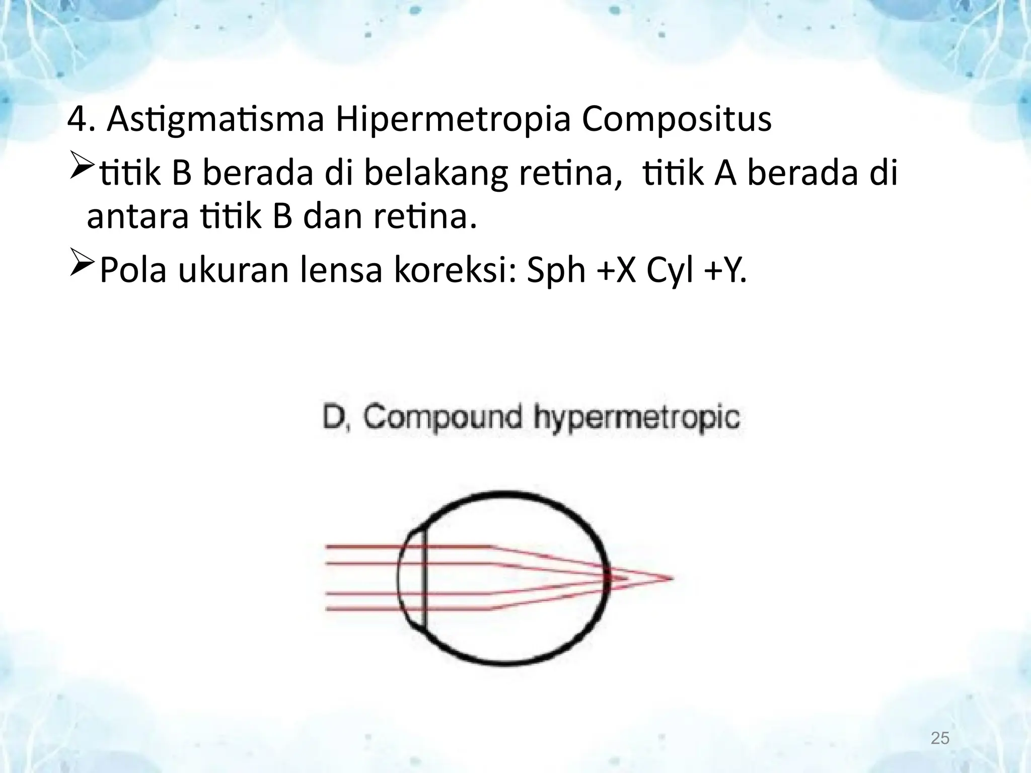 Kelainan Refraksi Miopia Hipermetropia Astigmat.ppt