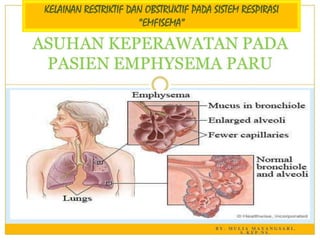 Asuhan Keperawatan Emfisema | PPTX