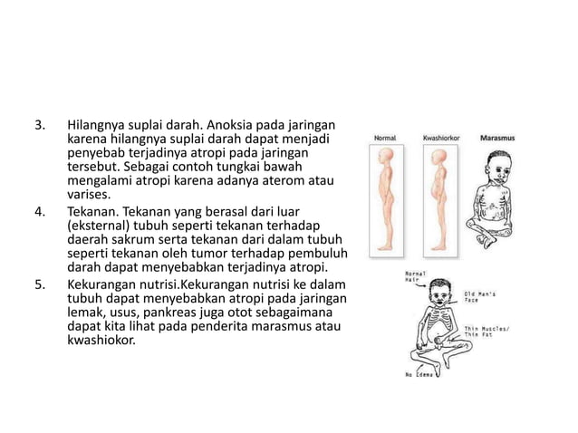 Kelainan Retrogresif.pptx