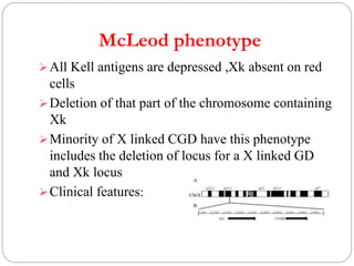 Kell blood group system | PPTX