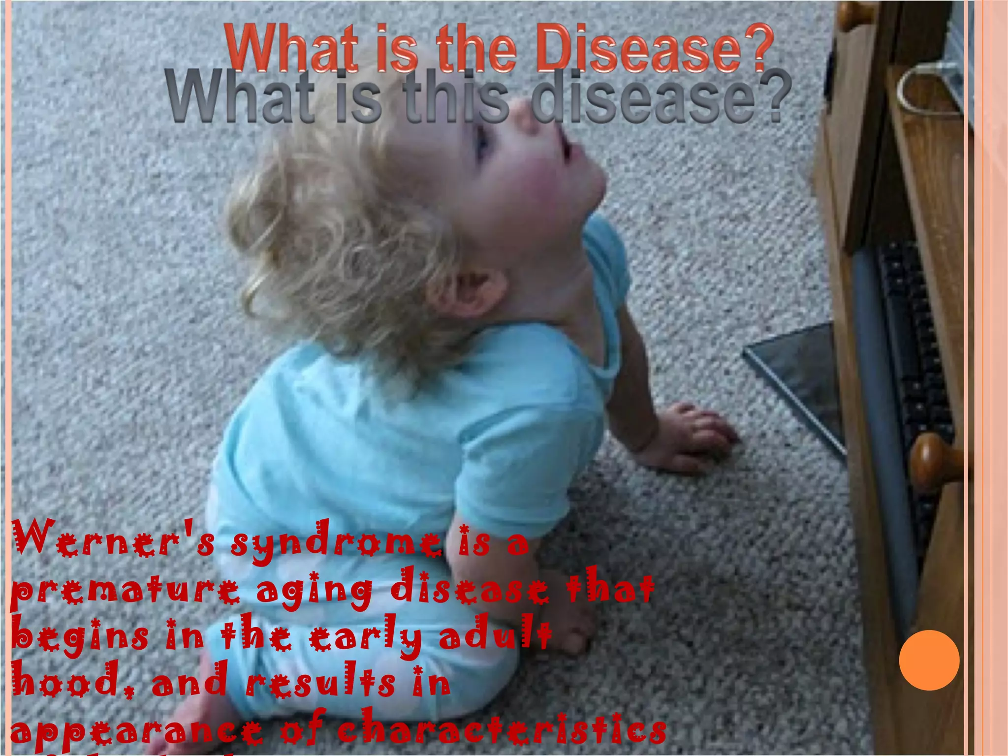 Werners Syndrome | PPT