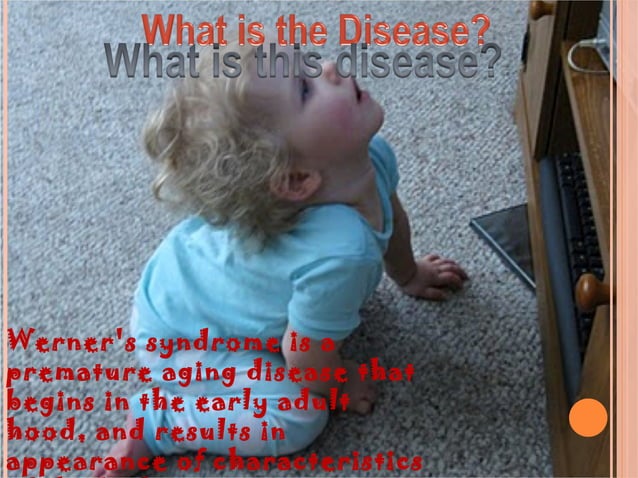 Werners Syndrome | PPT | Diseases and Conditions | Medical Health