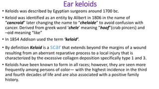 ear/aural keloid | PPTX
