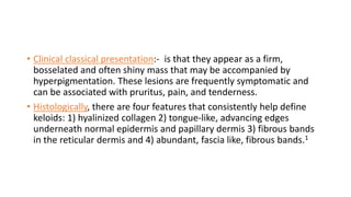 ear/aural keloid | PPTX