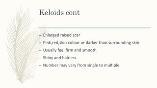 Keloids | PPTX