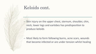 Keloids | PPTX