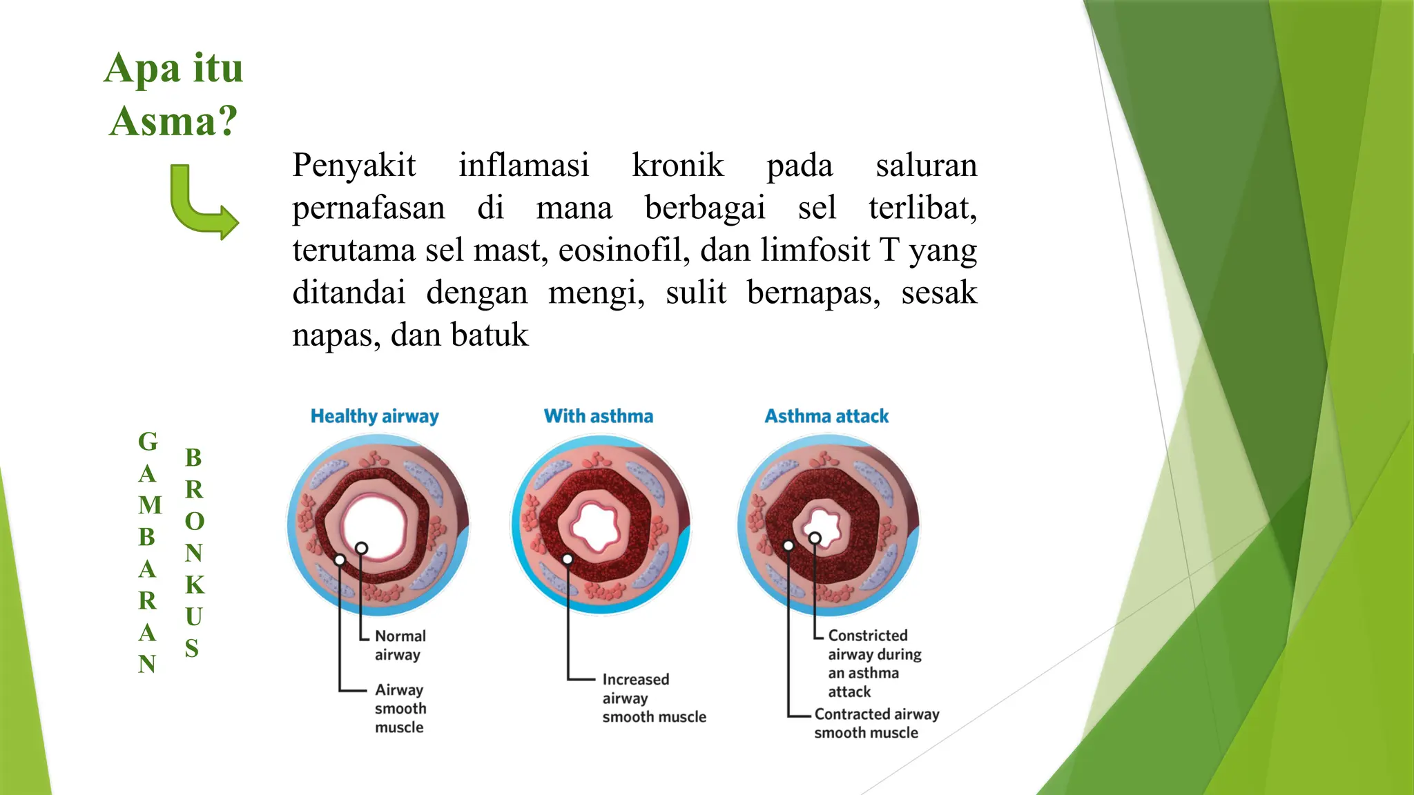 Farmakoterapi dan studi kasus pada pasien asma | PPTX