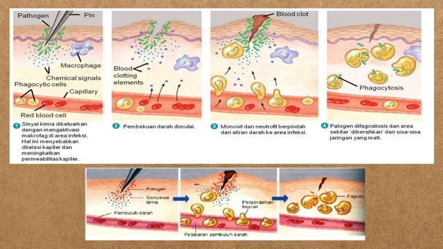 Mekanisme Respon Imun Inflamasi | PPTX