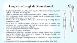 odontektomi kesehatan gigi dan miuulut di | PPTX
