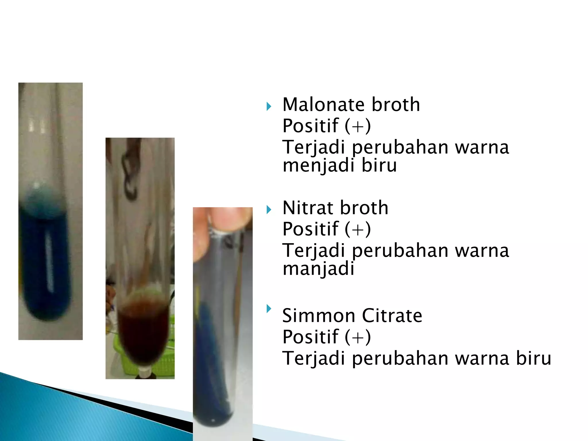 Isolasi bakteri pada sampel urin | PPTX