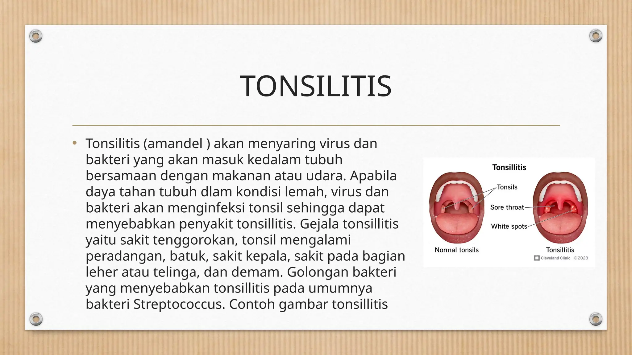 KELOMPOK 2 Gangguan sistem pernapasan (influenza, tonsilitis ...