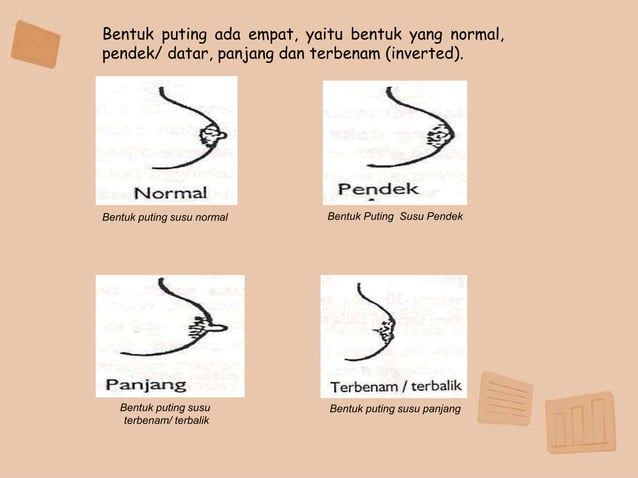 KELOMPOK 2 GLANDULA MAMMAE.pptx