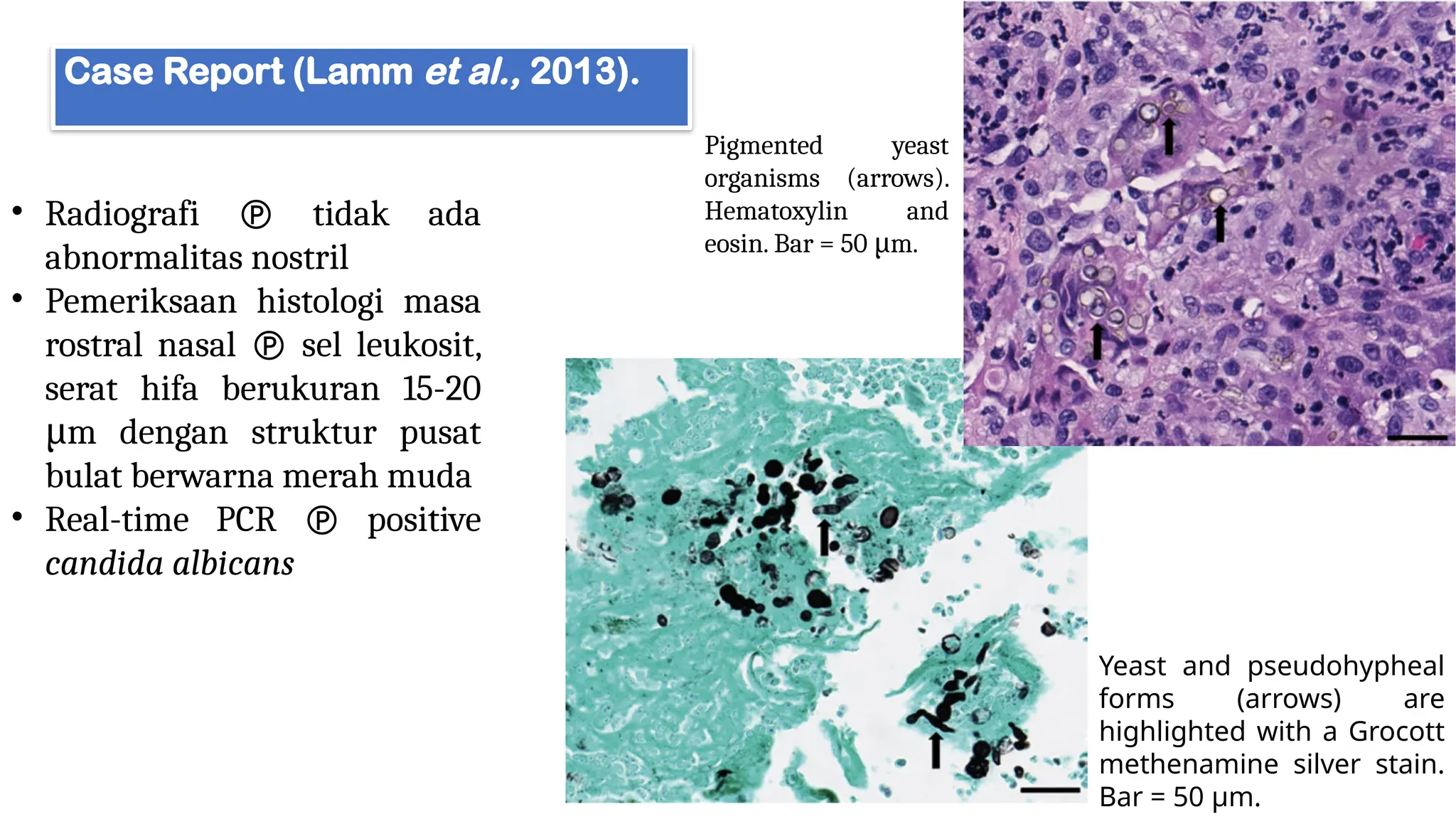 Kelompok_2_Patogenesis_Candidiasis_(1)[2][1] (1).pptx