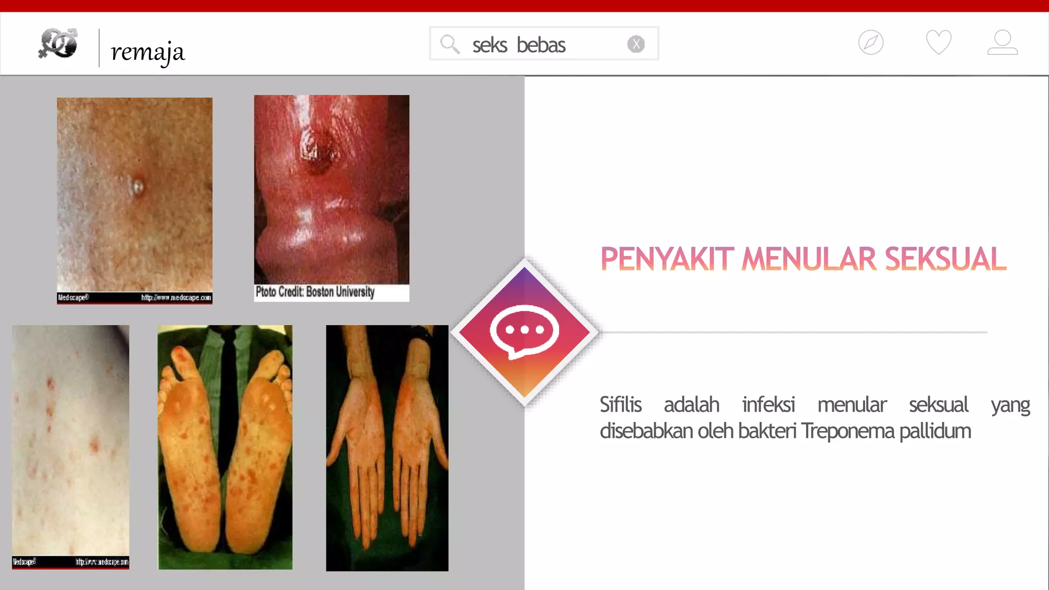 Seks Bebas pada Remaja | PPTX