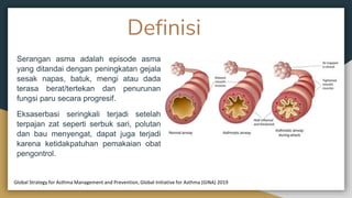 Kelompok 3-4 Kegawatdaruratan Asma .pptx