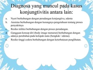 Konjungtivitis | PPTX