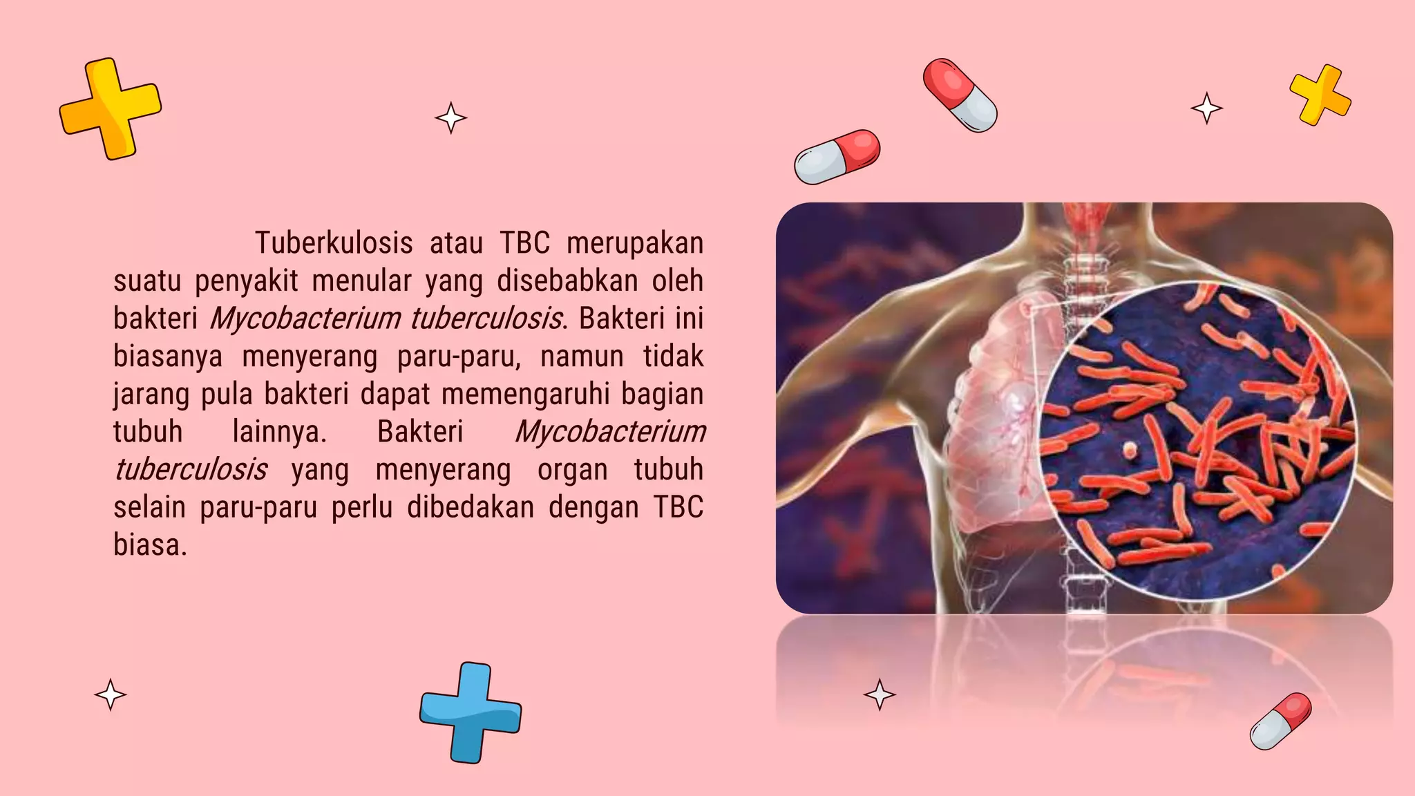 Kelompok 3 TBC (1).pptx