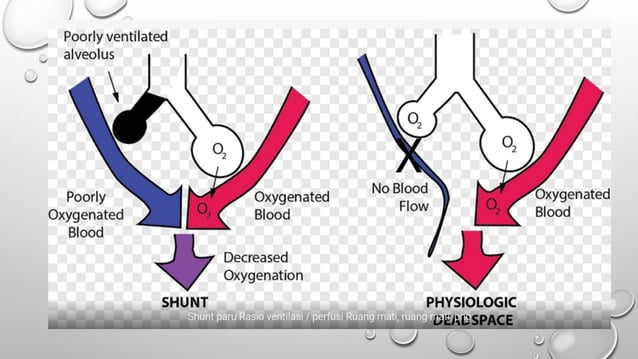 KELOMPOK 3 pkkvtd TRANSPORTASI & PERFUSI.pptx