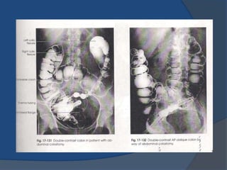 Teknik Radiografi 3 Pemeriksaan Lopografi | PPTX