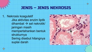 KELOMPOK 4 PATOFISIOLOGI.pptx