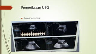 power point kelompok PELATIHAN USG DASAR.pptx