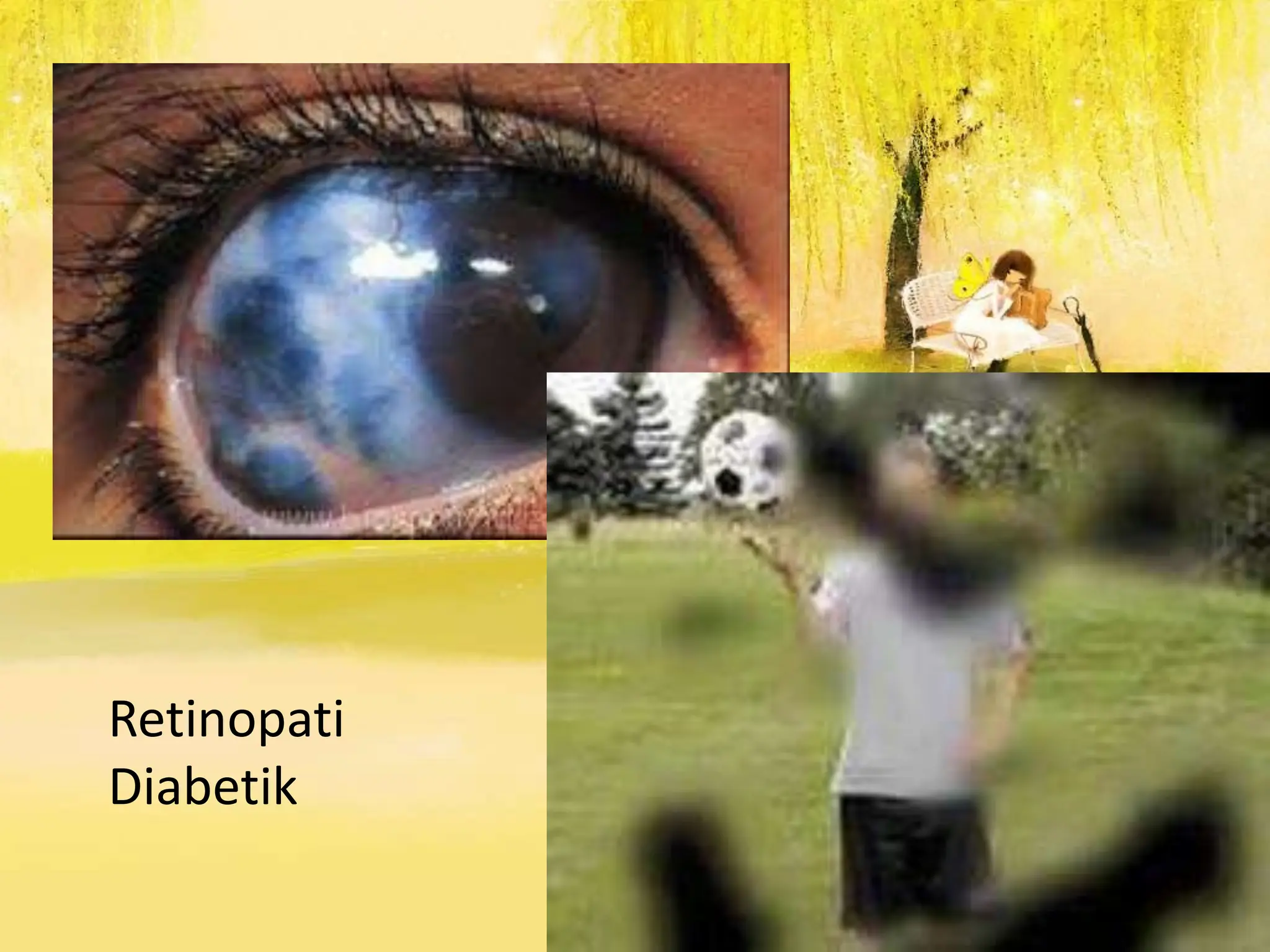 KELOMPOK 6 KOMPLIKASI DIABETES MELITUS.pptx