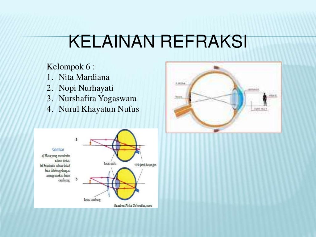 Kelainan Refraksi