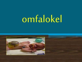 omfalokel | PPTX