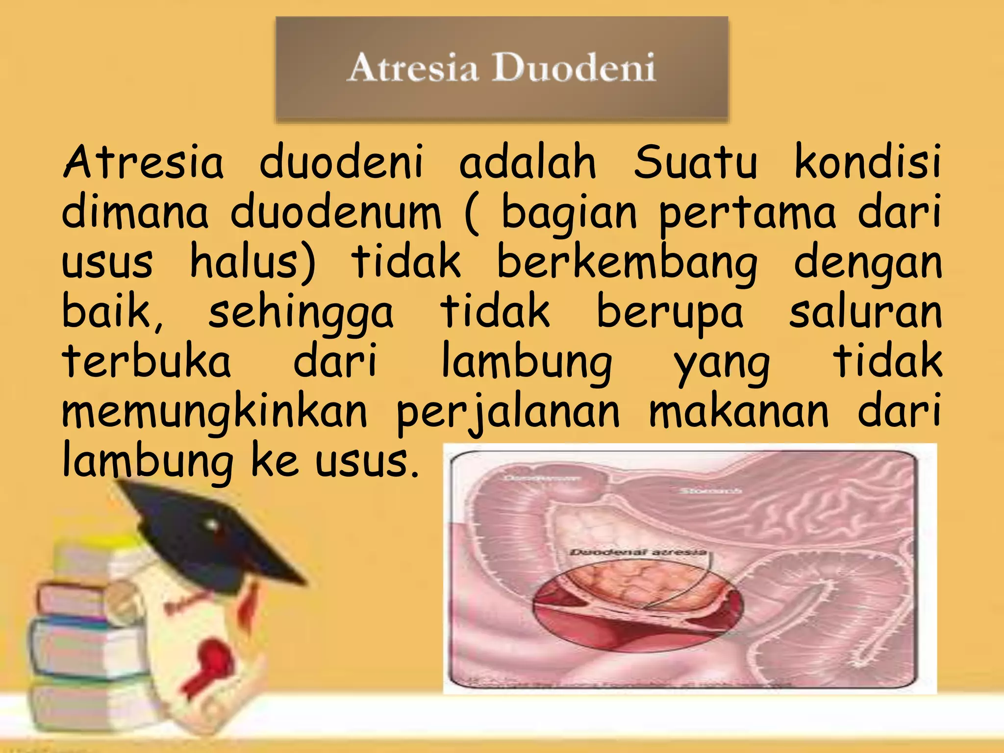 ATRESIA DUODENI DAN OESOPHAGUS | PPT