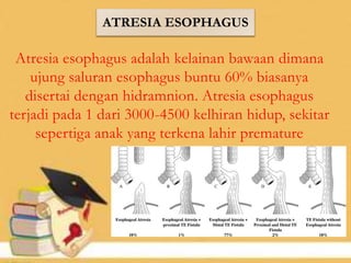 ATRESIA DUODENI DAN OESOPHAGUS | PPTX