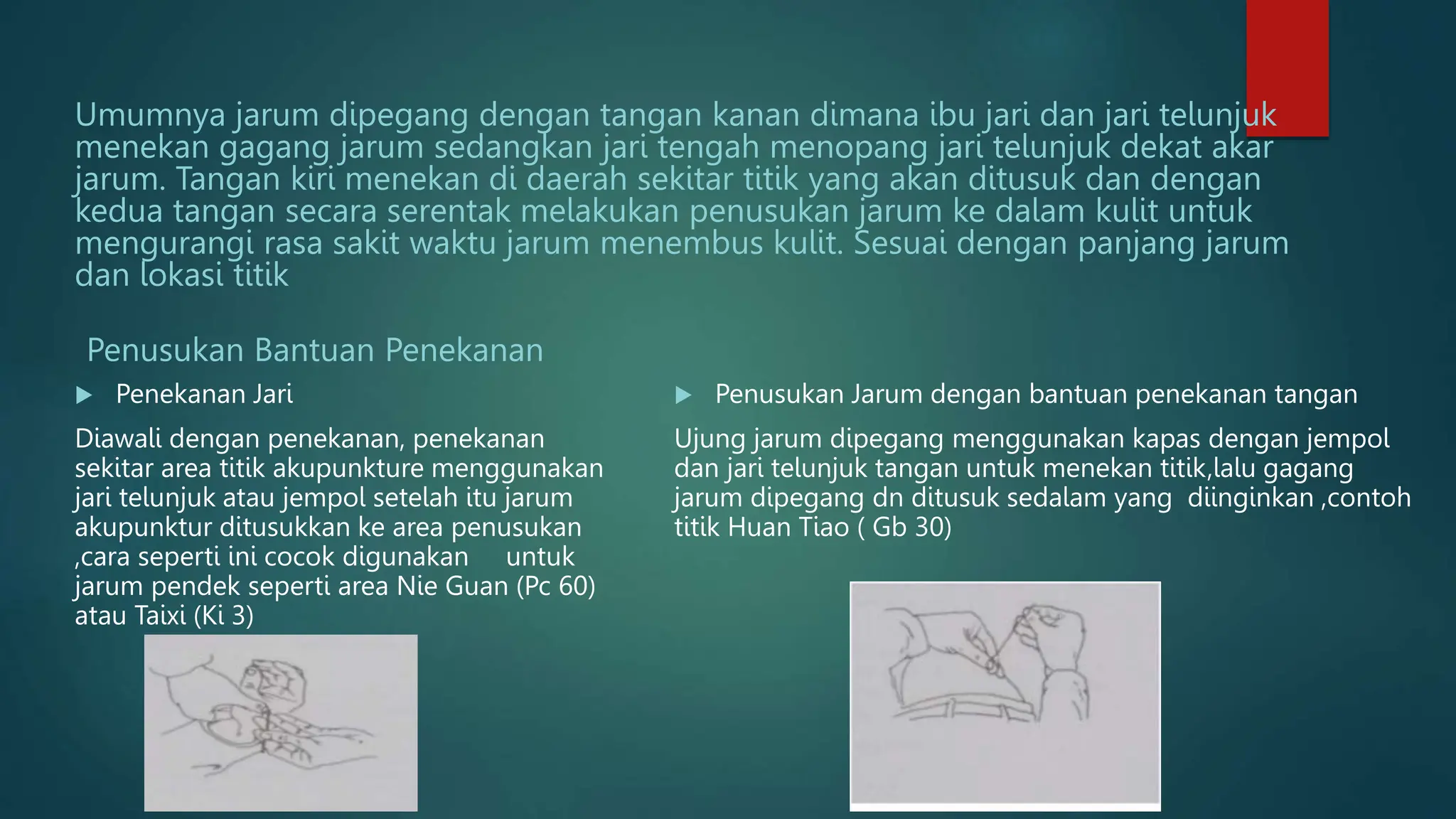tata cara penusukan dalam akupuntur dan metode | PPTX