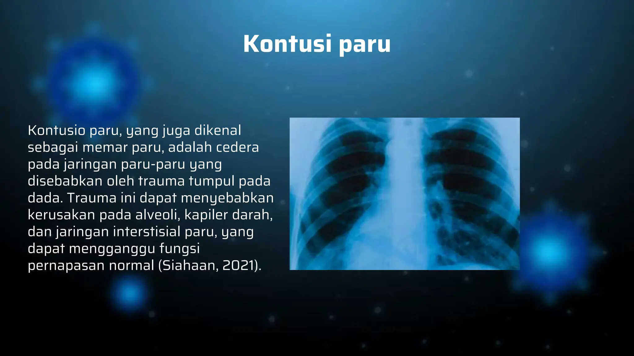 kuntio paru paru dan penyebabnya