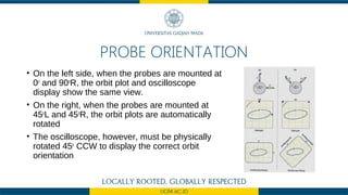 ORBIT PLOT ANALYSIS - VIBRATION ANALYSIS | PPT