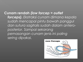 ekstraksi forceps-Kelompok iii | PPT