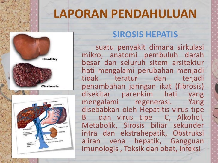 sirosis hepatis