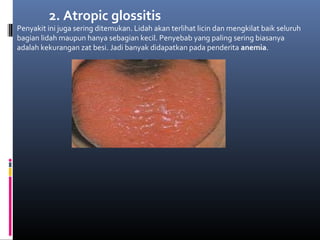 Kelompok lidah ix c | PPT