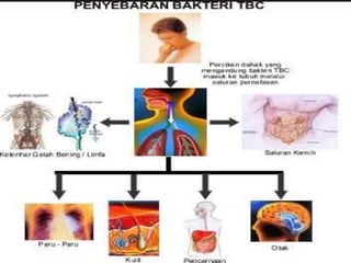 mikrobiologi tbc (TUBERKULOSIS) | PPTX