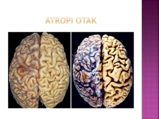 Kematian Pada Sel | PPTX