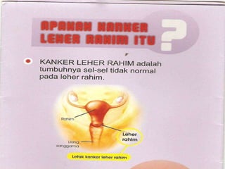 KENALI SEJAK DINI GEJALA KANKER LEHER RAHIM.ppt