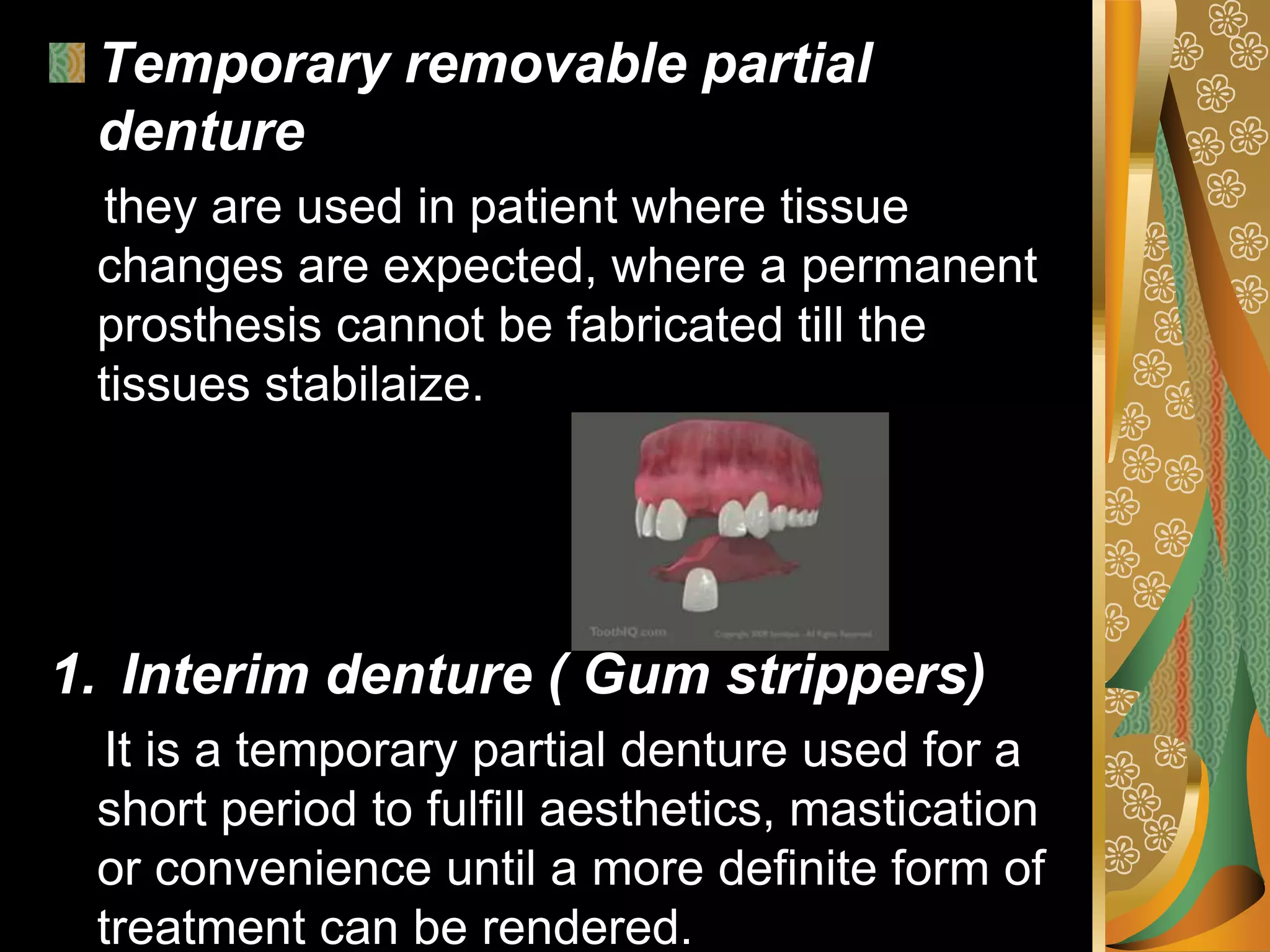 Kennedy classification | PPTX