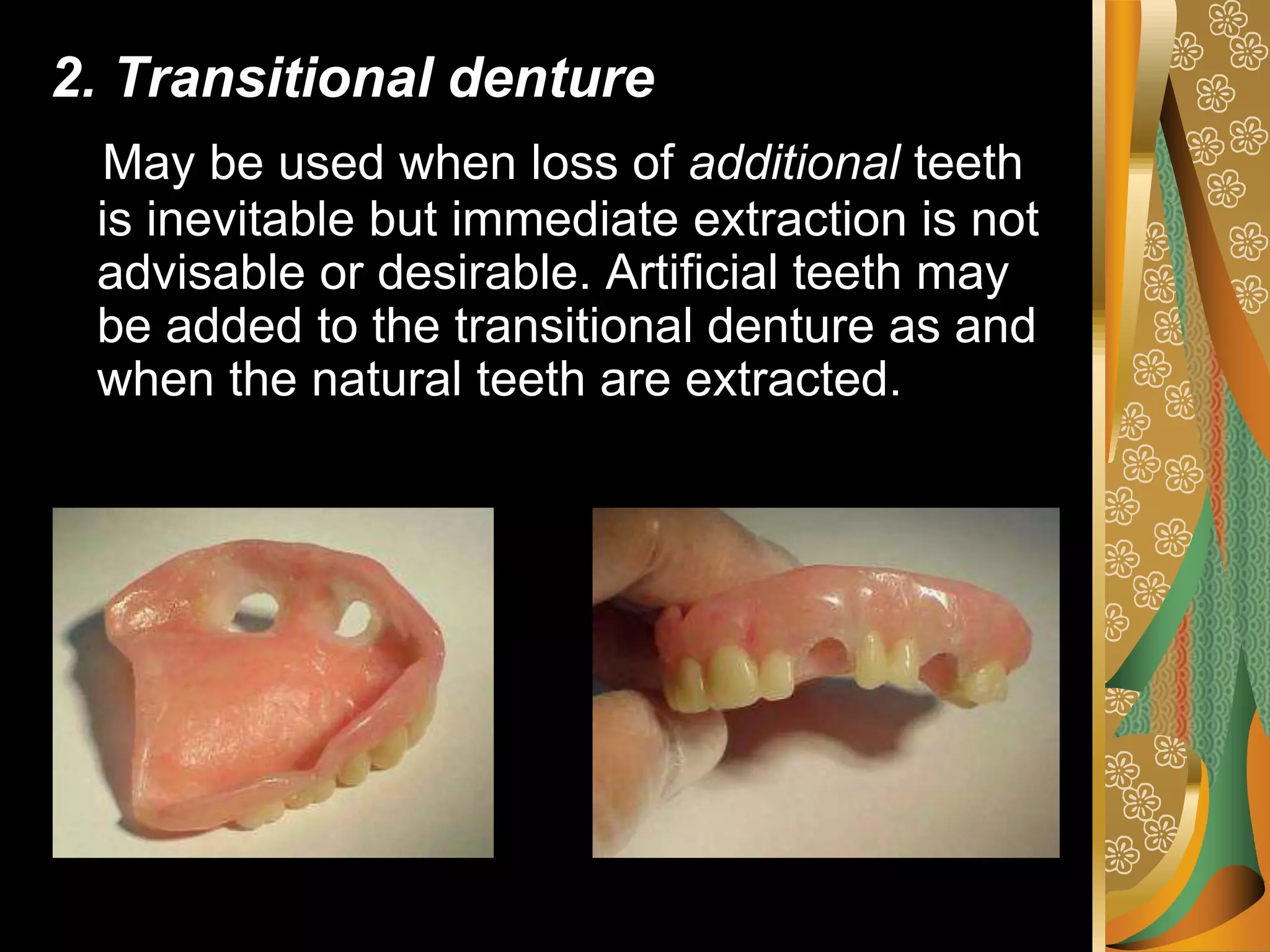 Kennedy classification | PPTX