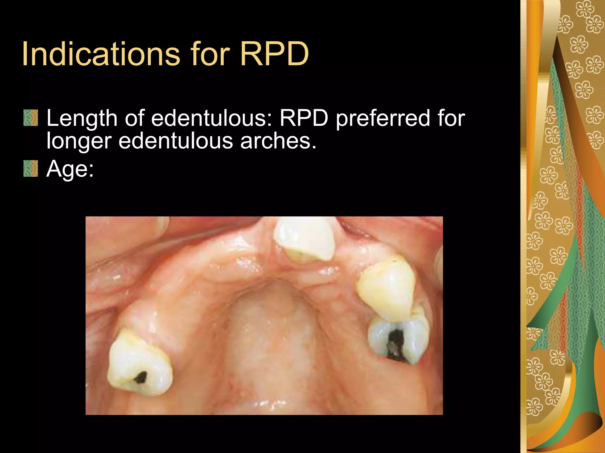 Kennedy classification | PPTX